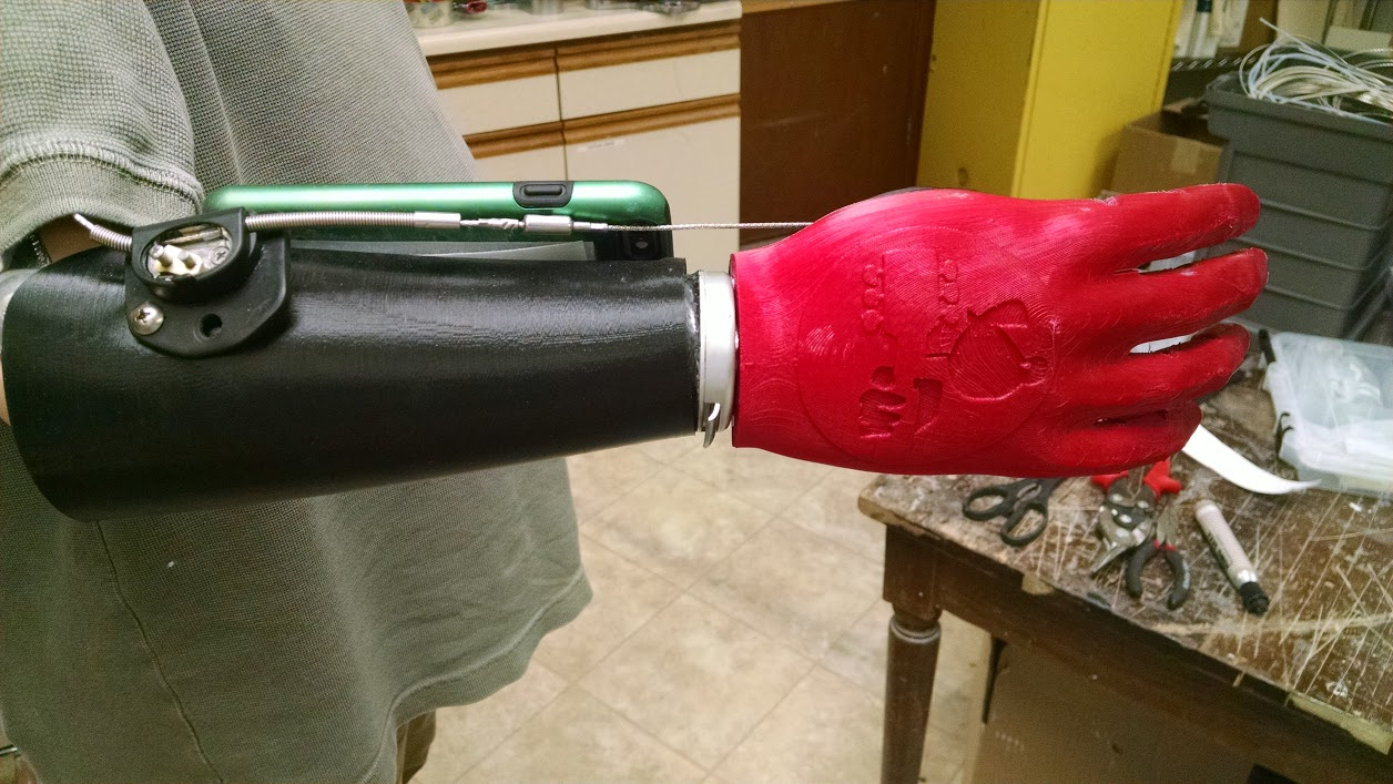 3D Printing Tips and Techniques 5: Prosthetics—the True HMIs | Machine ...