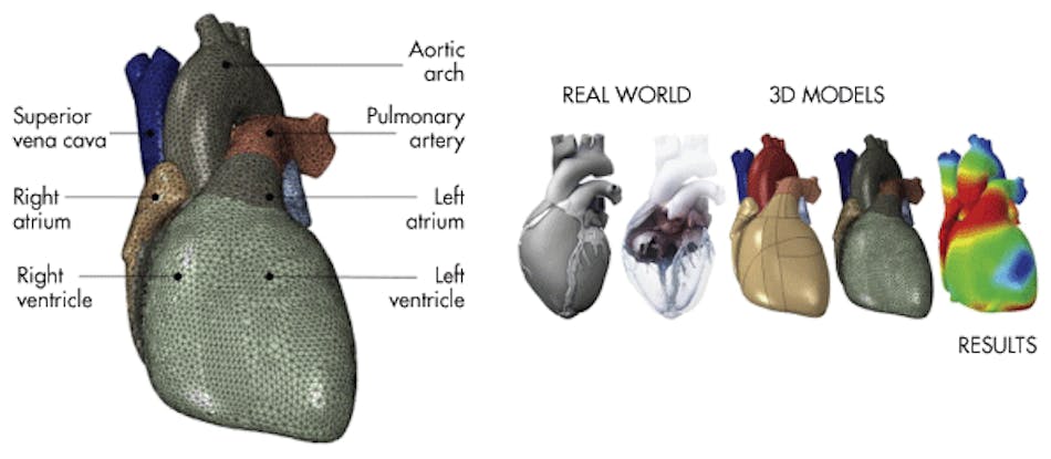 Expanding the Medical View with 3D CAD | Machine Design