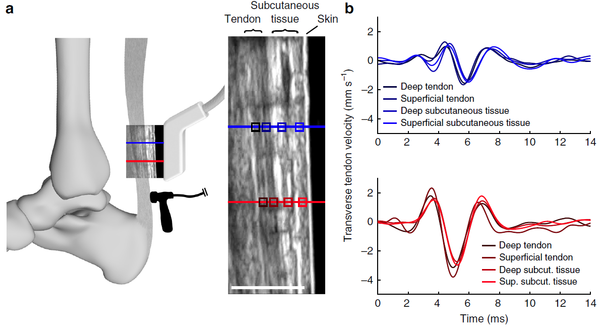 New Wearable Device Tracks Muscle Movements | Machine Design