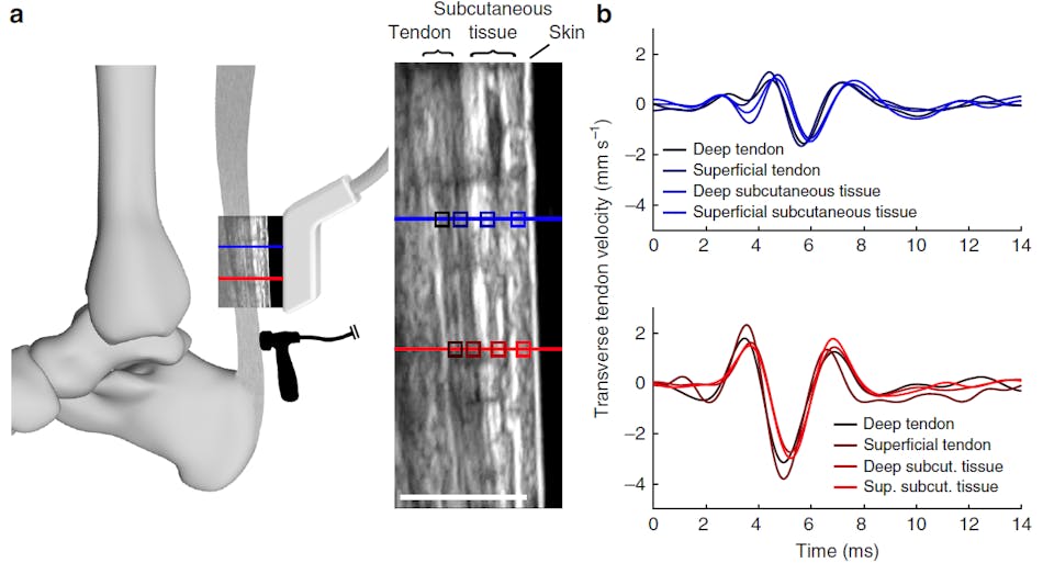 New Wearable Device Tracks Muscle Movements | Machine Design