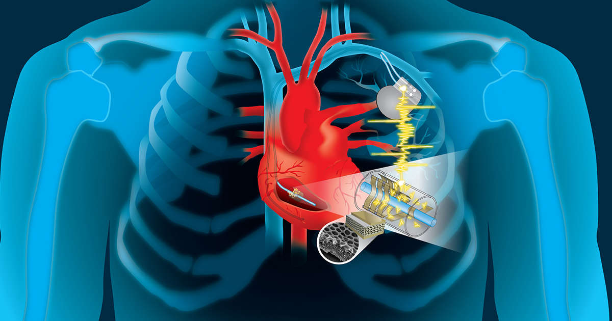 The Power of the Heartbeat to Charge Medical Devices | Machine Design