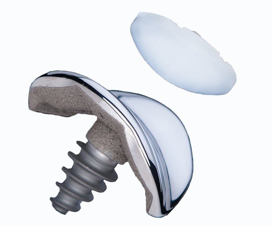 Redesigned Knee Joint Replacement Lets Patients Stay Active | Machine ...