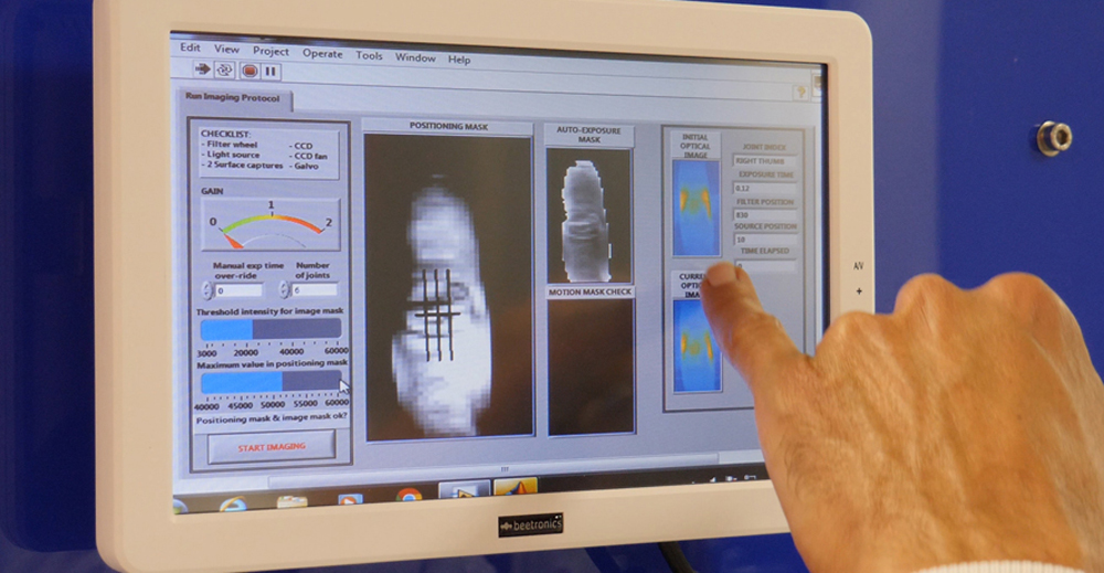 Optics, Electronics Combine for Non-Invasive, Accurate Arthritis ...