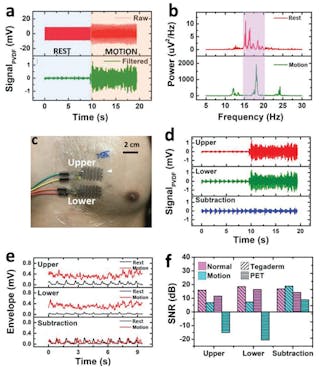 Flexible Electronic “Tattoo” is Versatile, Dual-Signal Heart-Monitor ...