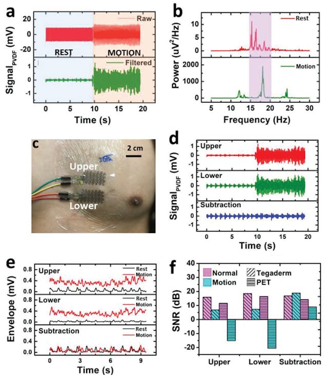 Flexible Electronic “Tattoo” is Versatile, Dual-Signal Heart-Monitor ...
