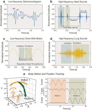MEMS-Like Accelerometer-Microphone Captures Lung, Cardiac “Vibe” for ...