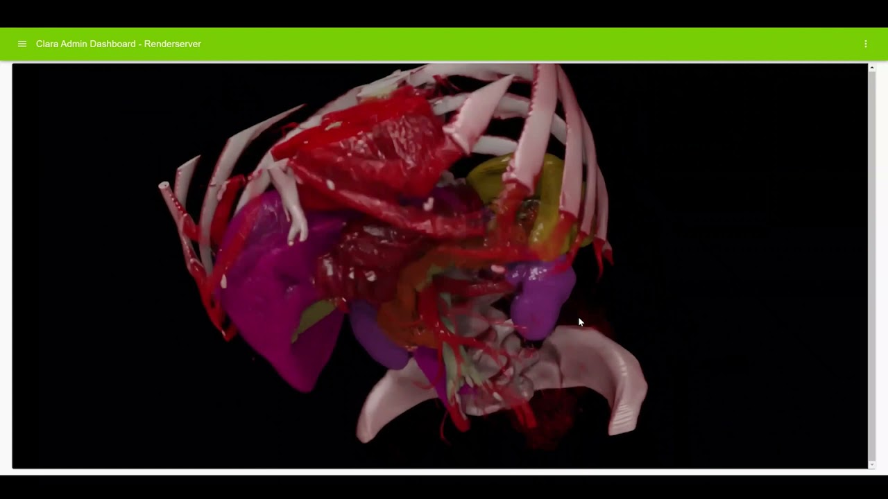 NVIDIA Clara Holoscan: AI Computing for Medical Devices | Machine Design