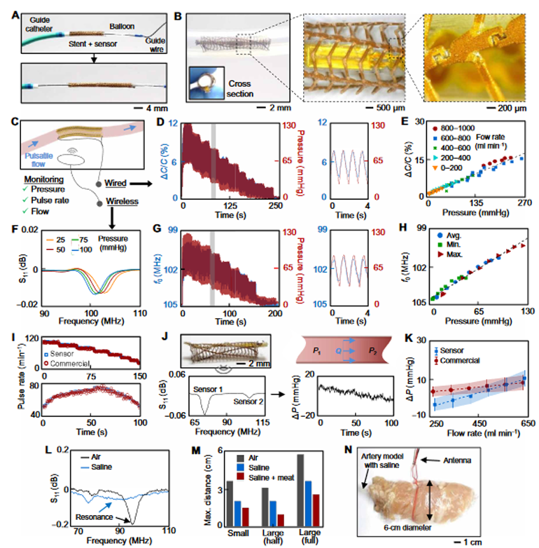 Printed Inductive Stent + Sensor Captures, Reports Blood-Flow Data ...