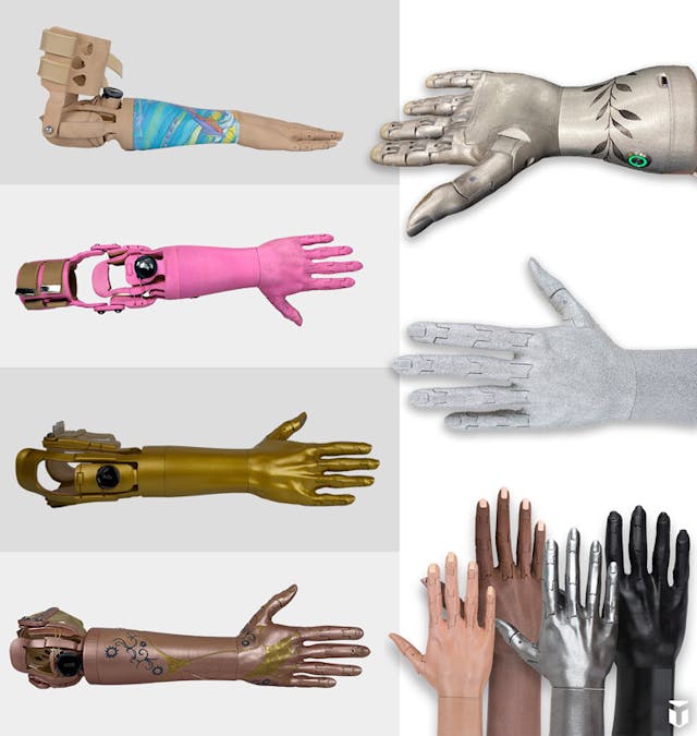 Making Prosthetic Arms for Those in Need | Machine Design