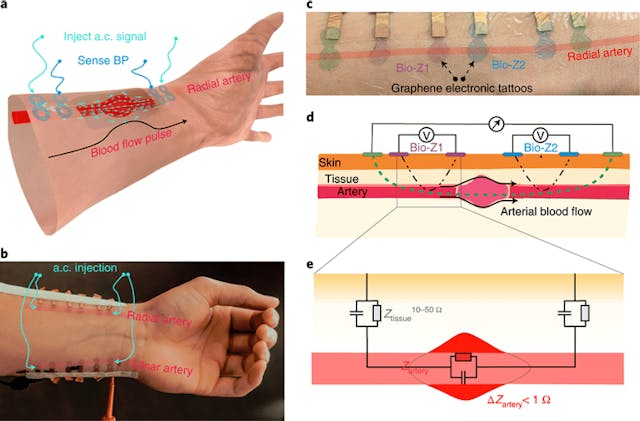 Graphene “Tattoo” Delivers Continuous Blood-Pressure Monitoring ...