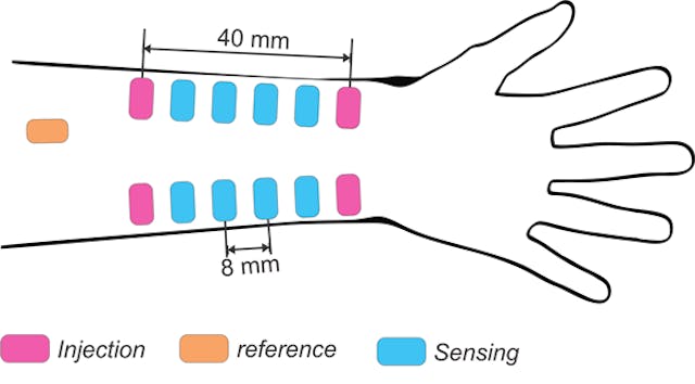 Graphene “Tattoo” Delivers Continuous Blood-Pressure Monitoring ...