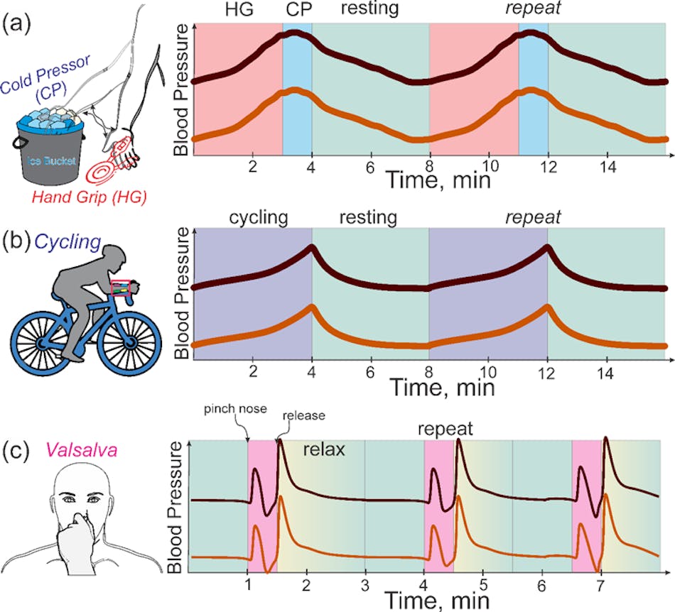 Graphene “Tattoo” Delivers Continuous Blood-Pressure Monitoring ...